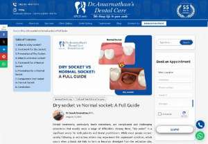 Dry socket vs Normal socket : A Full Guide - Viesearch