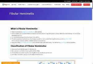 Fibular Hemimelia: Expert Care for Limb Differences at Trishla Ortho ...